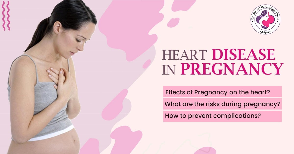 Heart disease in pregnancy treatment in Jaipur, cardiac Pregnancy ...