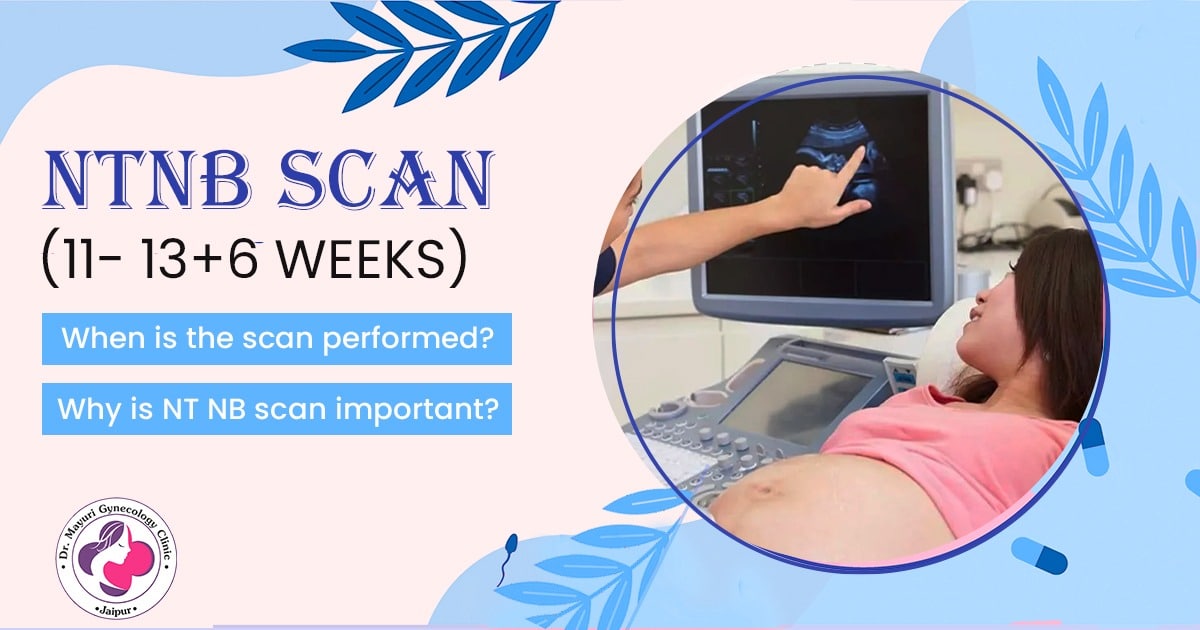 NT Scan in Jaipur (with Cost), NT Scan Center in Sitabadi, Jaipur