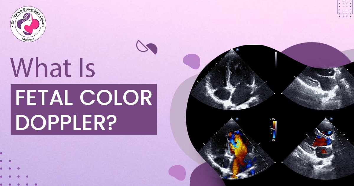 Colour Doppler test in Jaipur, Color Doppler ultrasound centre & price